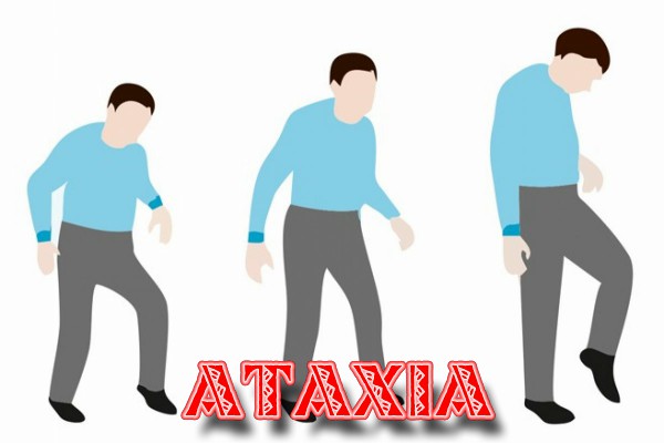 La ataxia agrupa a un conjunto de trastornos neurológicos que afectan ...